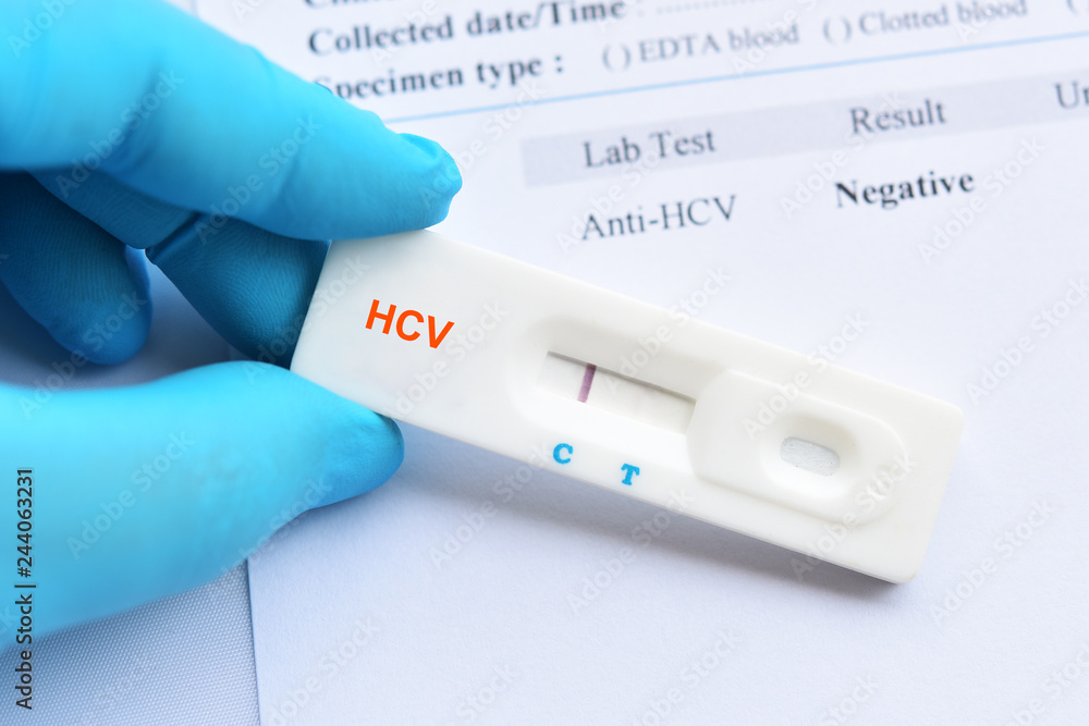 Hepatitis C virus negative test result by using rapid test cassette ...