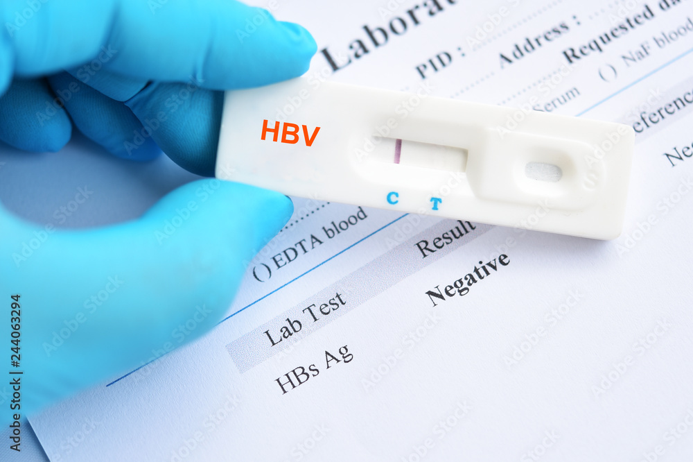 Hepatitis B virus negative test result by using rapid test cassette ...