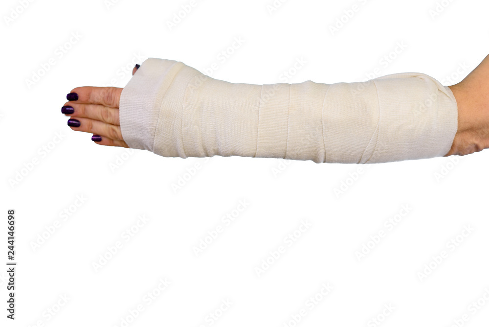 Hand Fracture Plaster