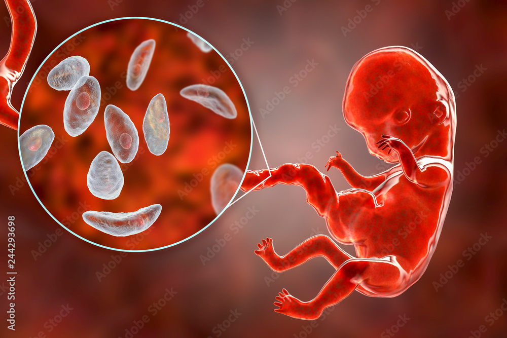 Transplacental transmission of Toxoplasma gondii parasites to human ...