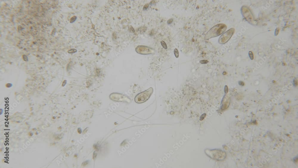 Video „Motion of single-celled animals (infusoria) under microscope ...