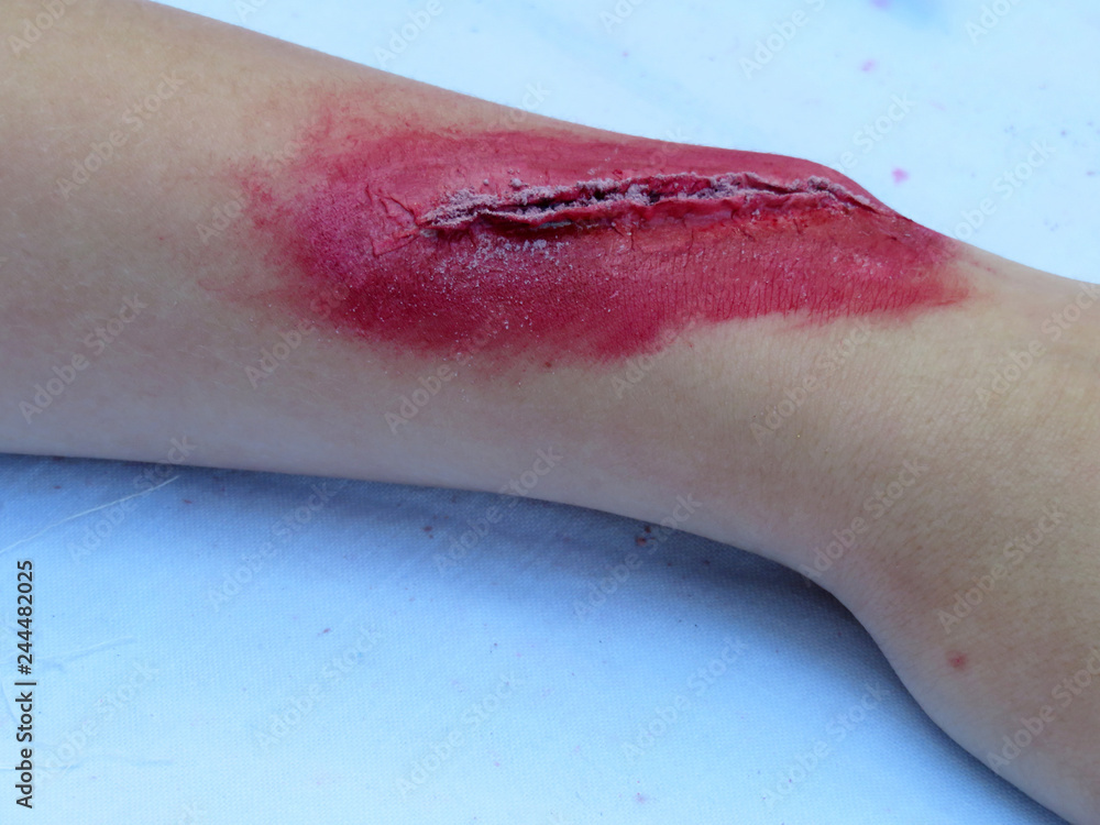 Poster Heavy wound on a human hand. Bloody wound makeup special effect ...