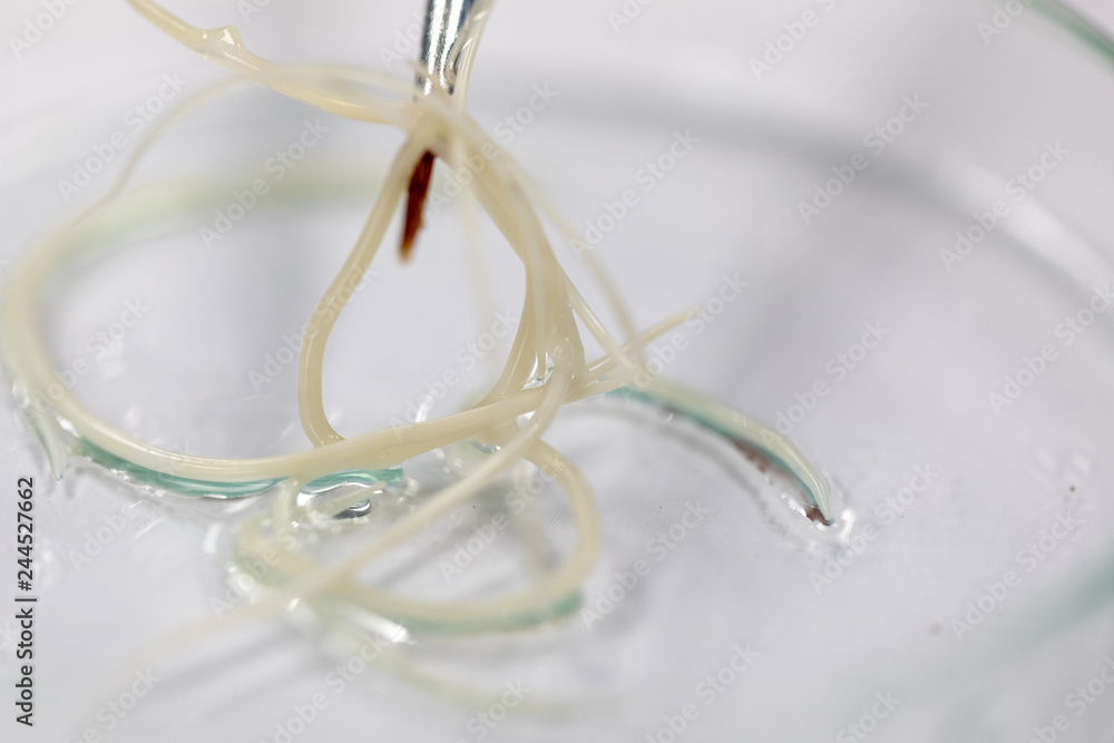 Ascariasis is a disease caused by the parasitic roundworm Ascaris ...