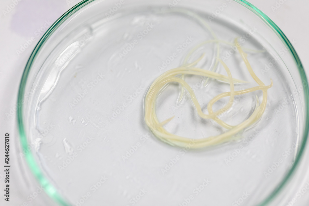 Ascariasis is a disease caused by the parasitic roundworm Ascaris ...