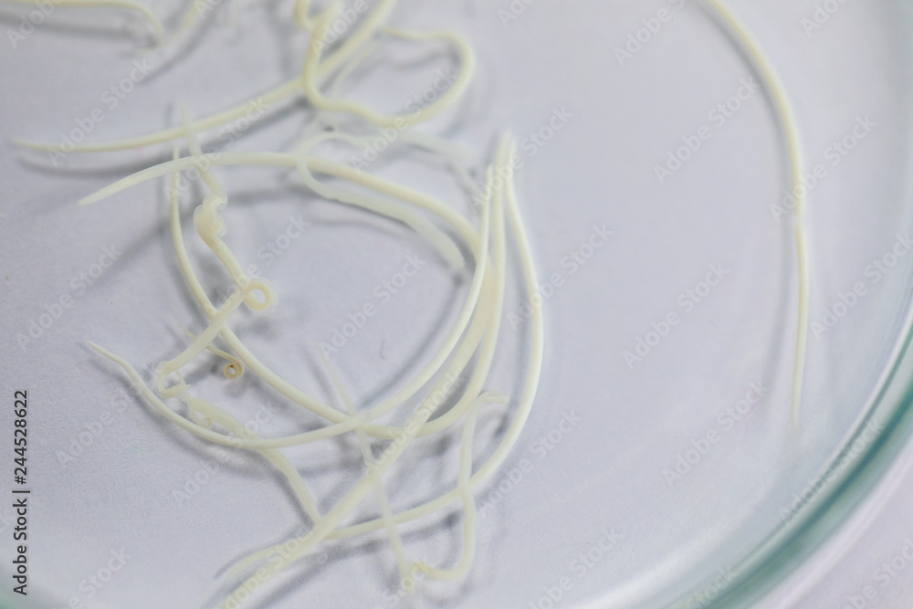 Ascariasis is a disease caused by the parasitic roundworm Ascaris ...