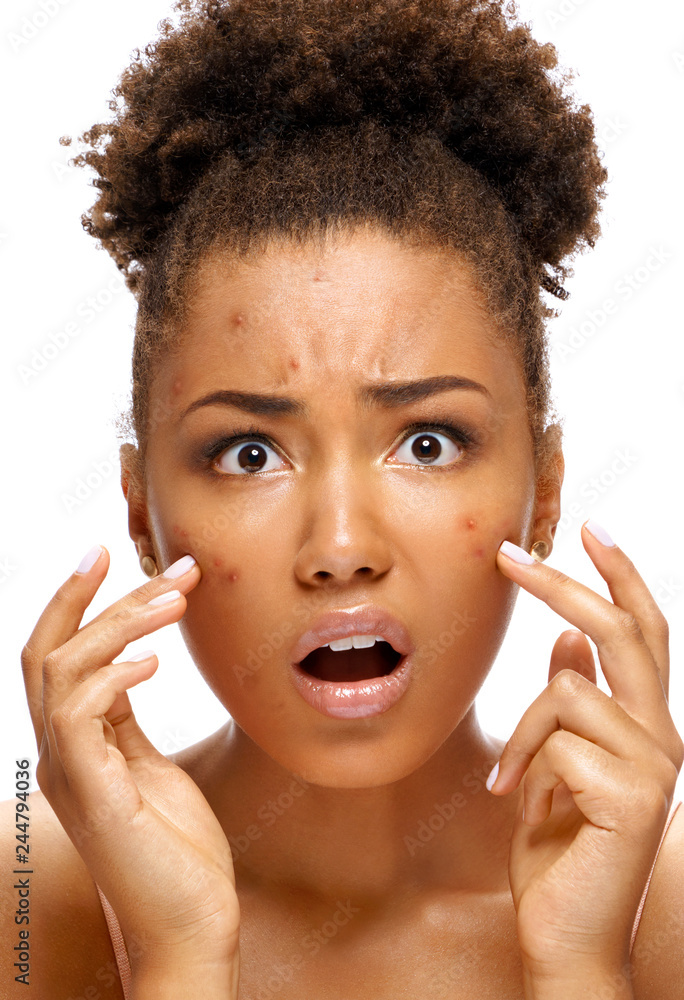 Ugly teen girl in shock of her acne. Photo of african american girl ...