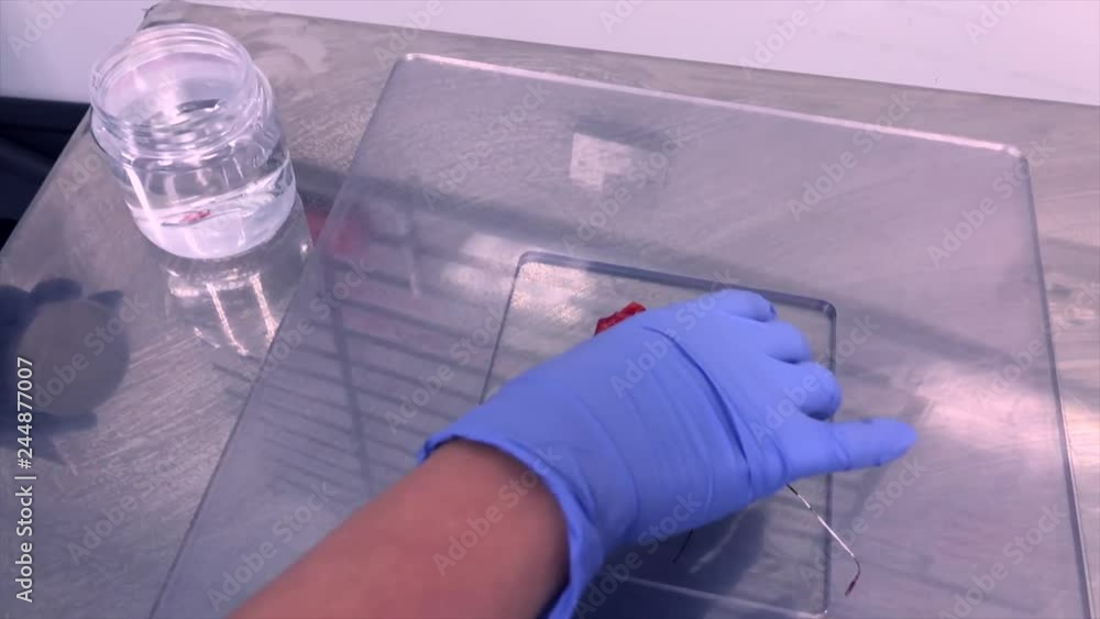 A surgeon finalises sutures on a prosthetic breast implant during ...