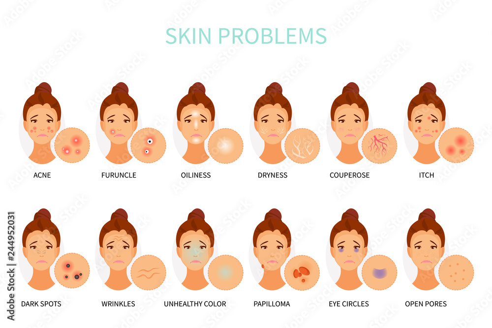 Skin problems vector Stock Vector | Adobe Stock