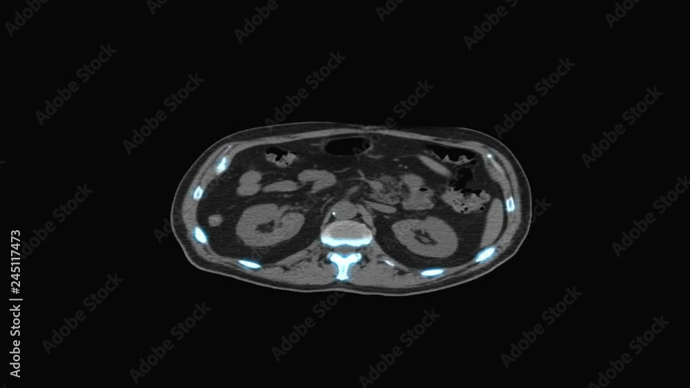 MRI scans of human body. Medical radiology examinations monitor. Black ...
