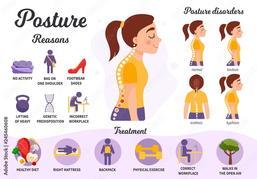 Infographics of posture disorders. Causes of the disease, treatment ...
