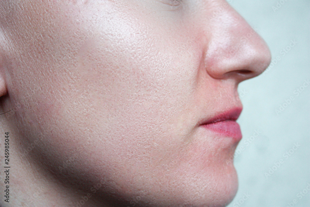 skin face. little girl large pores. white Stock Photo | Adobe Stock