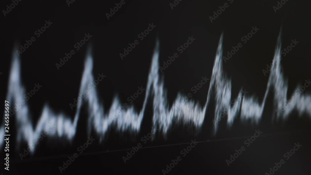 Close up video of ultrasound monitor. Ultrasonography machine ...