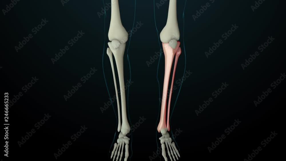 3d rendered footage of skeleton structure with injured bones. Bone pain ...