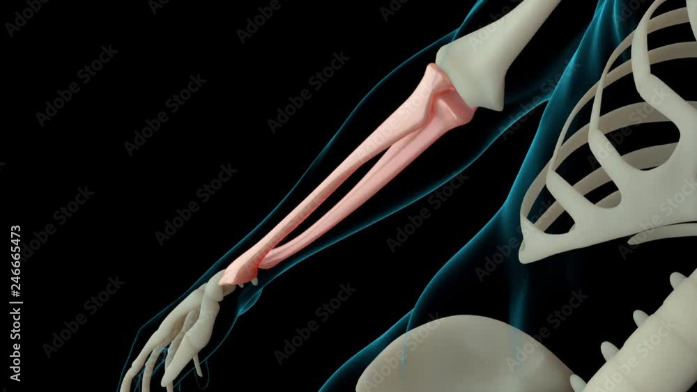3d rendered footage of skeleton structure with injured bones. Bone pain ...