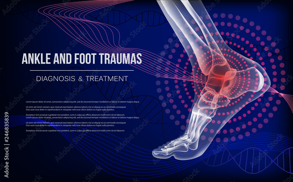 Horizontal dark blue banner for ankle and foot joints traumas Stock ...