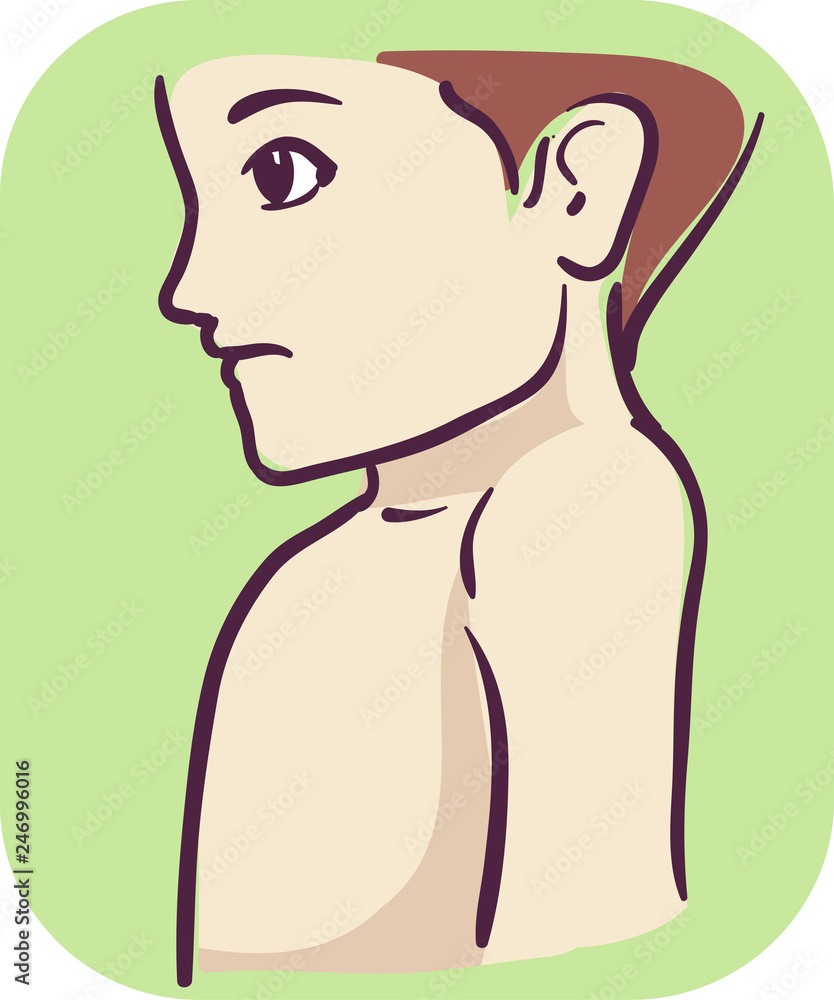 Kid Boy Symptom Short Neck Illustration Stock Vector | Adobe Stock