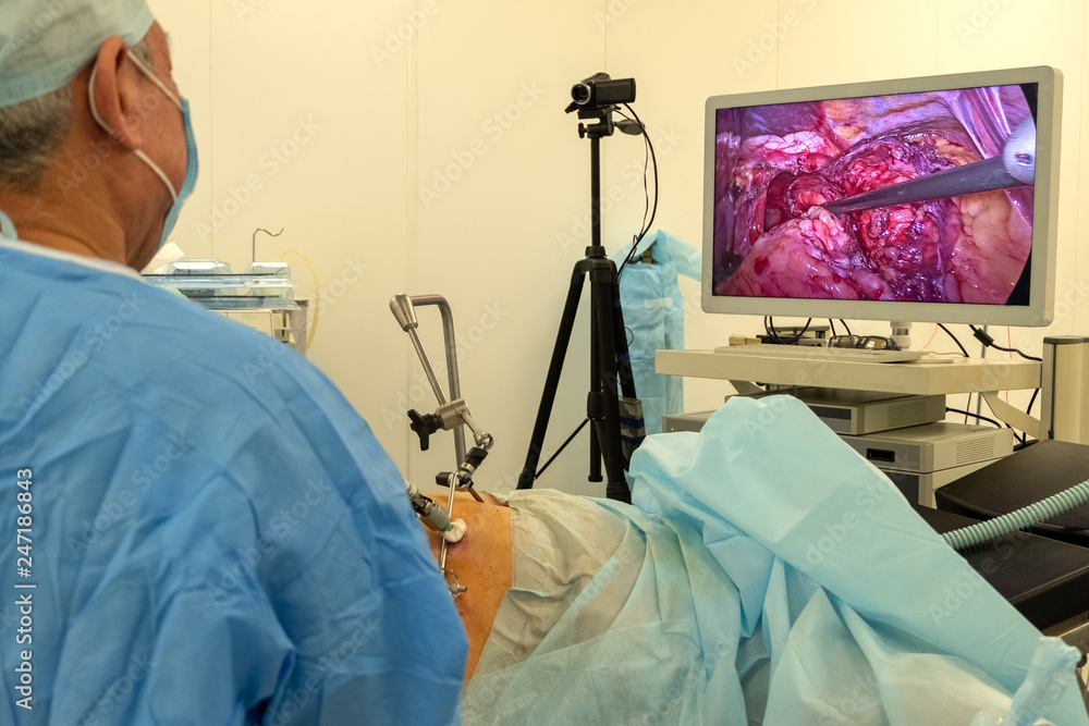 Record any video camera and live broadcast of the surgeon. Video image ...