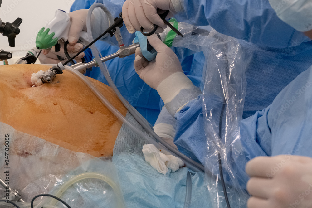 The work of surgeons using endo video of surgical instruments in the ...