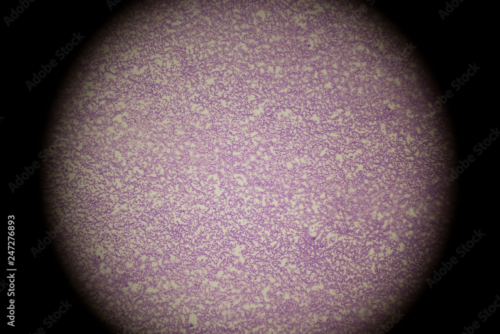 blood smear under microscope Stock Photo | Adobe Stock