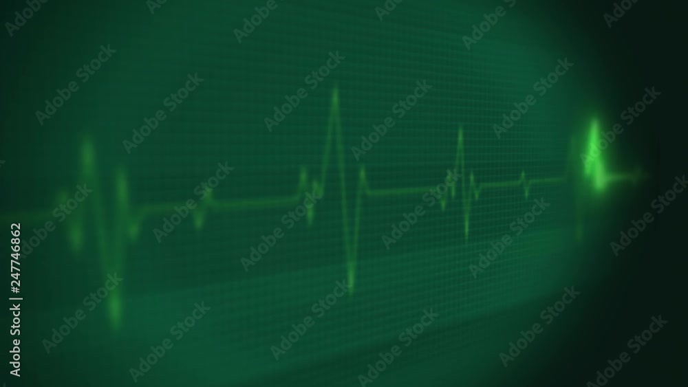 4k Medical Heart Pulsation Wave Signal/ Animation of a health ...