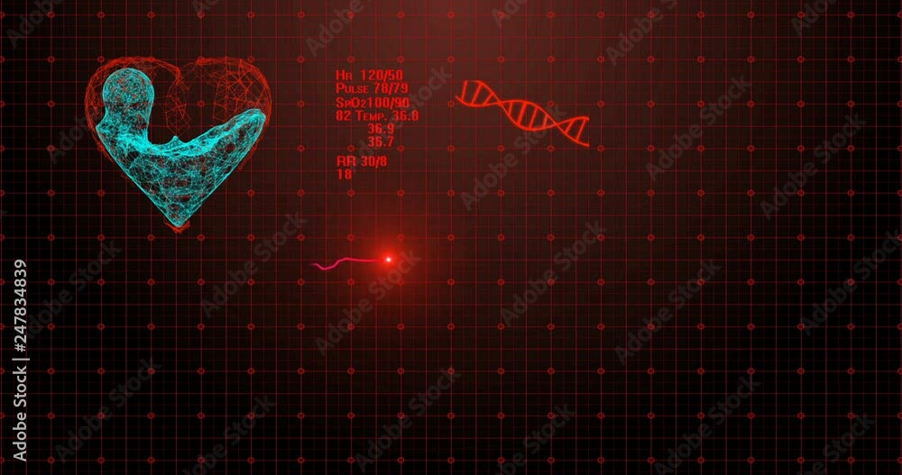 Video Stock ECG cardiac monitor goes flat line. ECG showing a pulsing ...