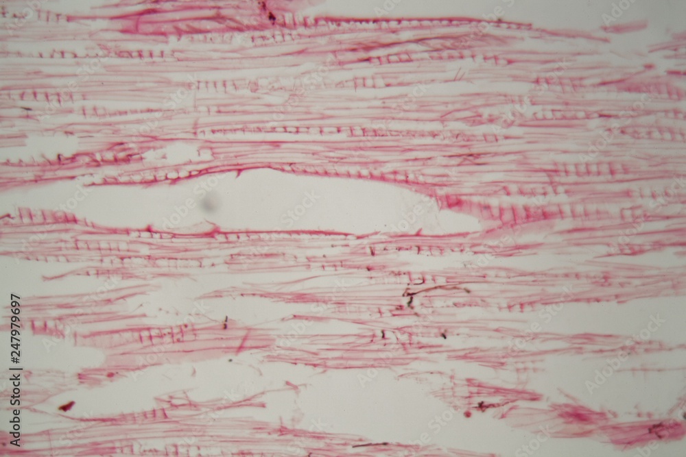 Wood cells destroyed by fungus under a microscope foto de Stock | Adobe ...