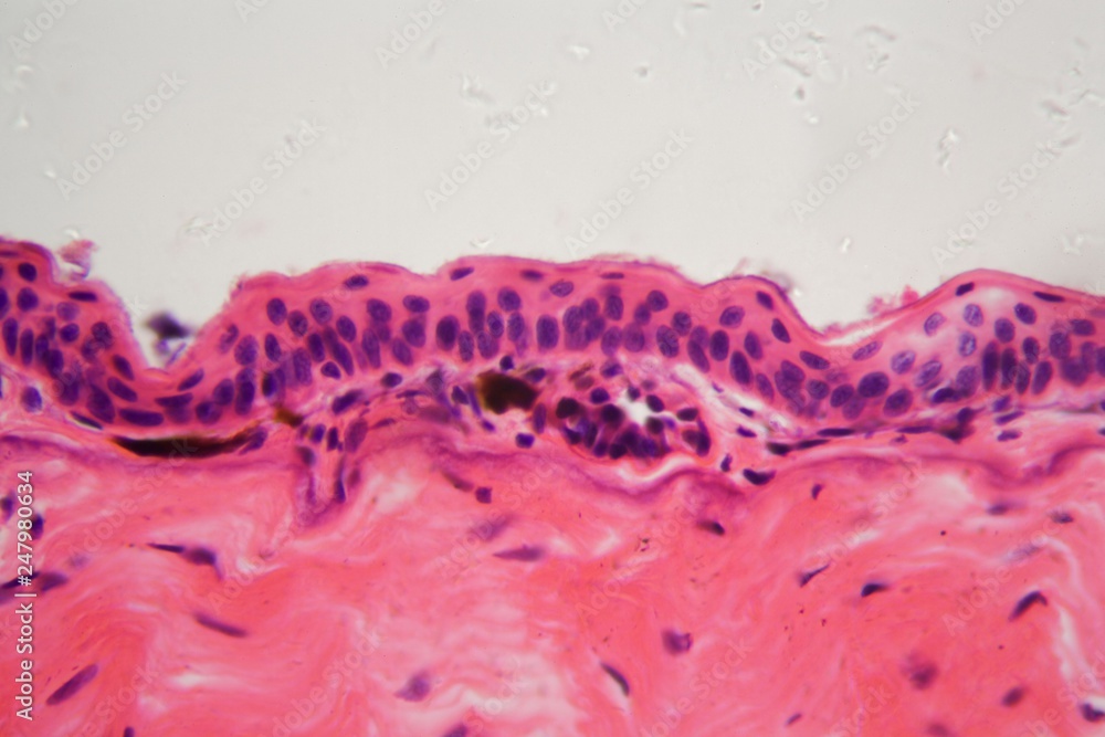 Poster Amphibian skin with ulcer under a microscope – Tableau | Europosters