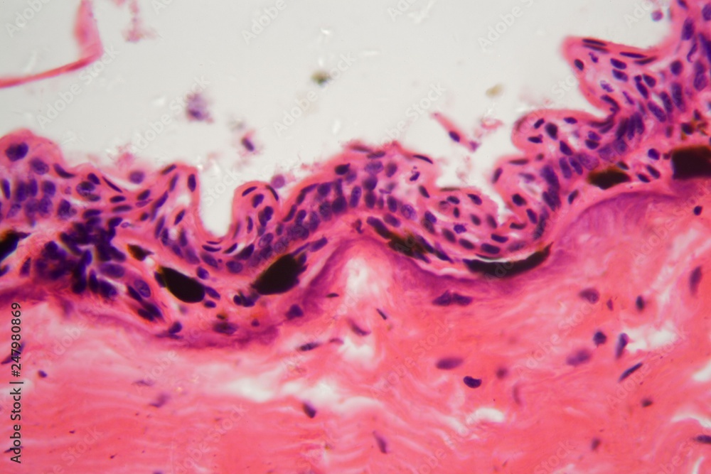 Amphibian skin with ulcer under a microscope Stock Photo | Adobe Stock