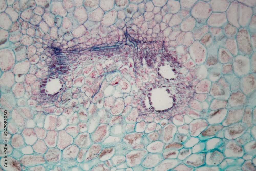 Plant cells with damages caused by a parasitic animal under the ...