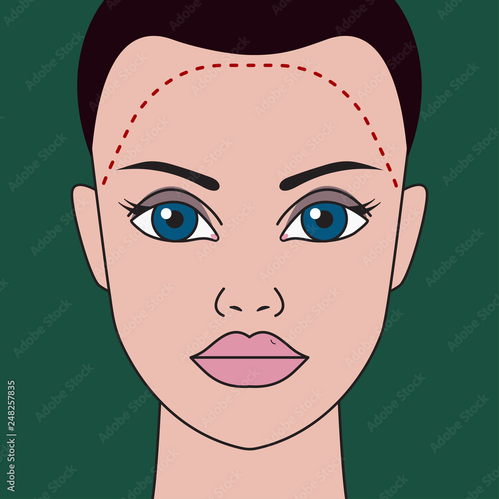 correction of receding hairline Stock Vector | Adobe Stock