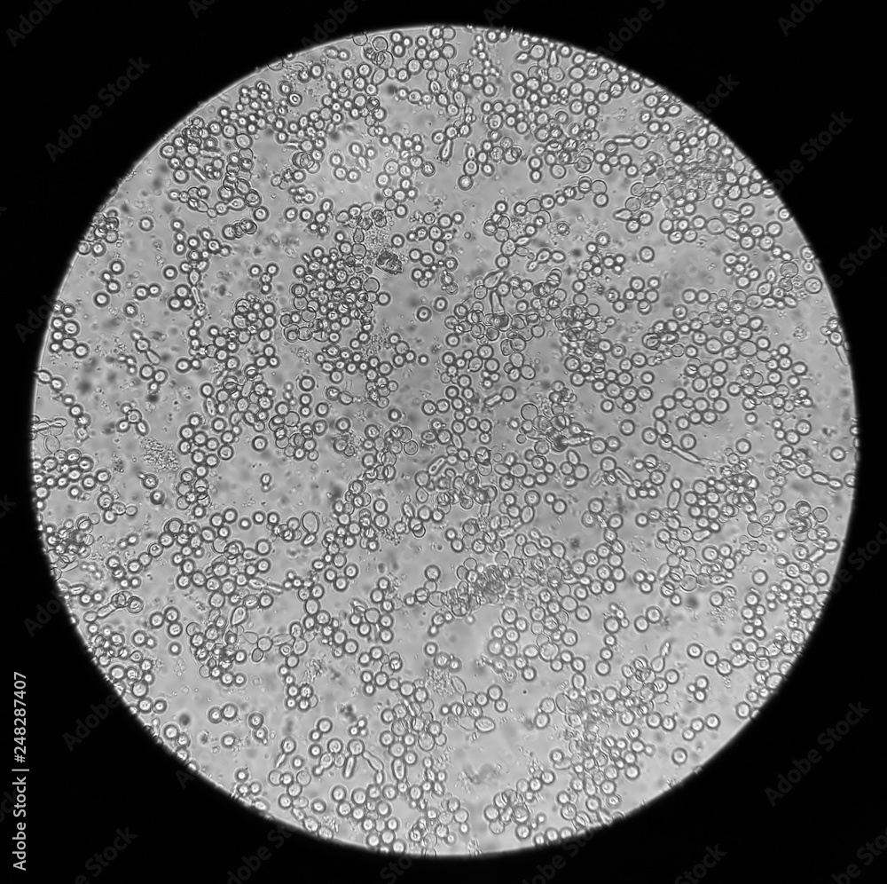 microscopic view of the fungi candida albicans Stock Photo | Adobe Stock