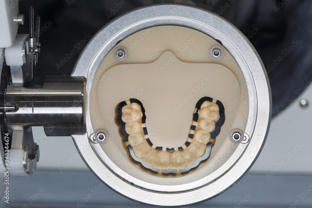 Dental milling equipment and temporary prosthesis Stock Photo | Adobe Stock