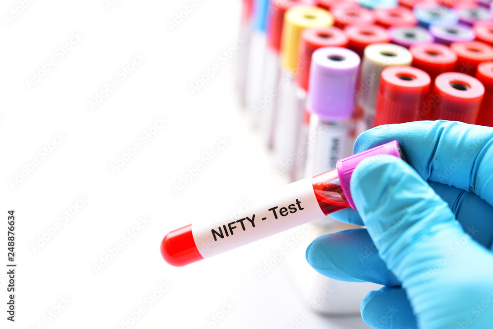 Blood sample for NIFTY or Non Invasive Fetal Trisomy test, diagnosis ...