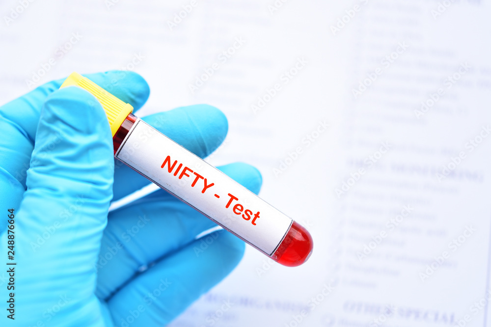 Blood sample for NIFTY or Non Invasive Fetal Trisomy test, diagnosis ...
