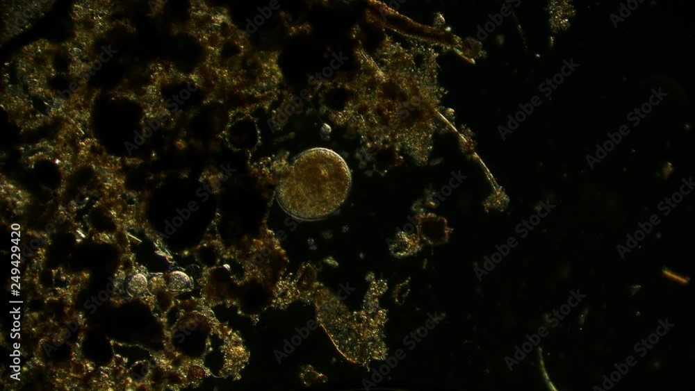 unicellular organism under microscope – off-axis dark field ...