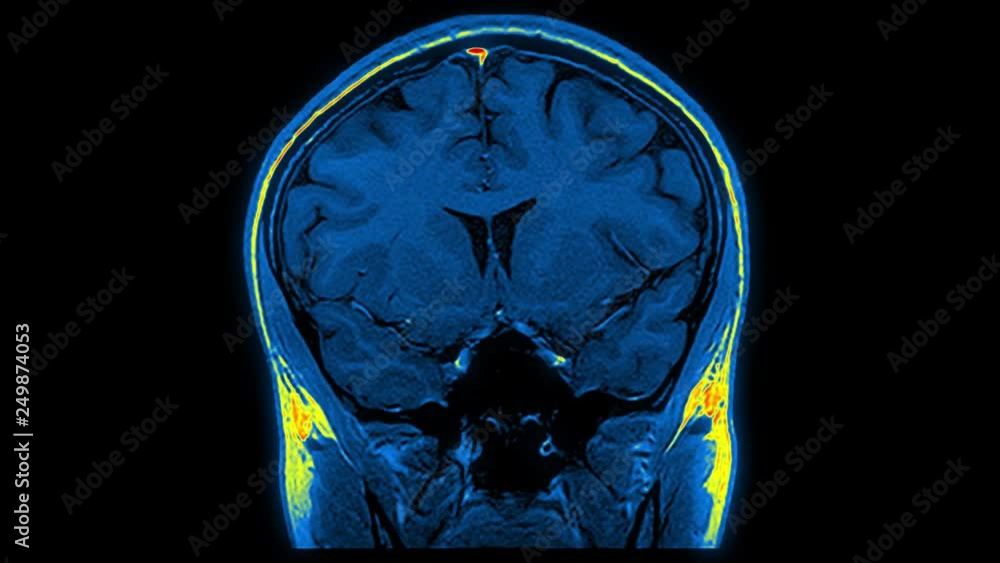 Computed medical tomography MRI upscaled scan of healthy young female ...