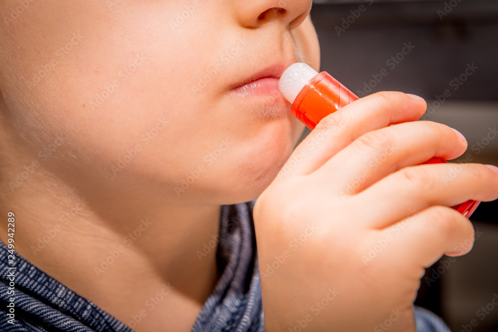 Problem of drying lips in a child. The little boy smears his lips with ...