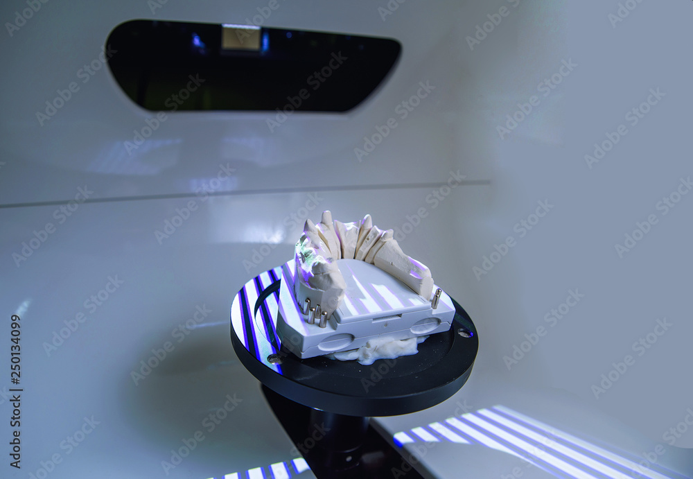 Specialized dental 3D scanner reads information from the plaster model ...