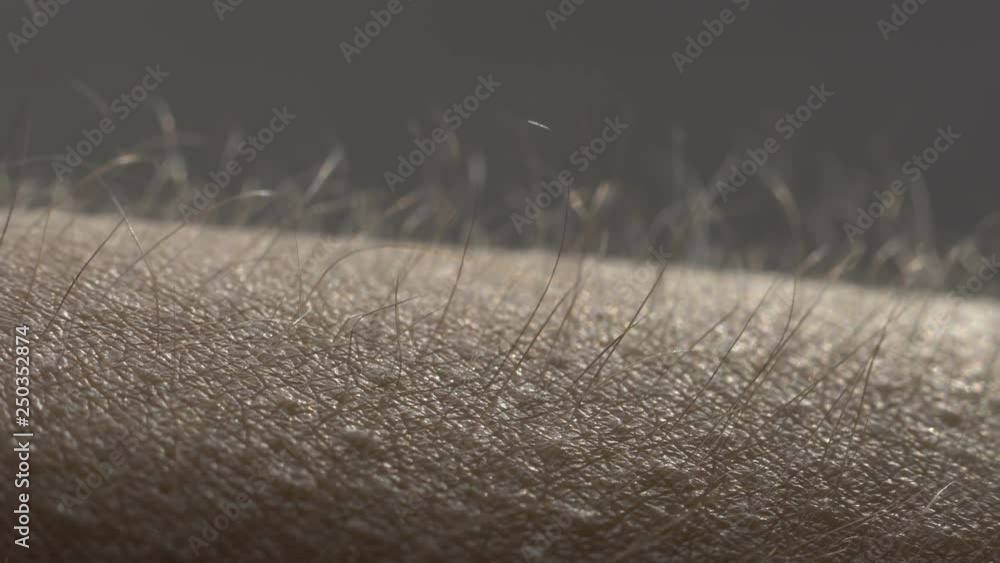 Goosebumps macro. Hair on the hand rise up. Skin reaction to cold, fear ...