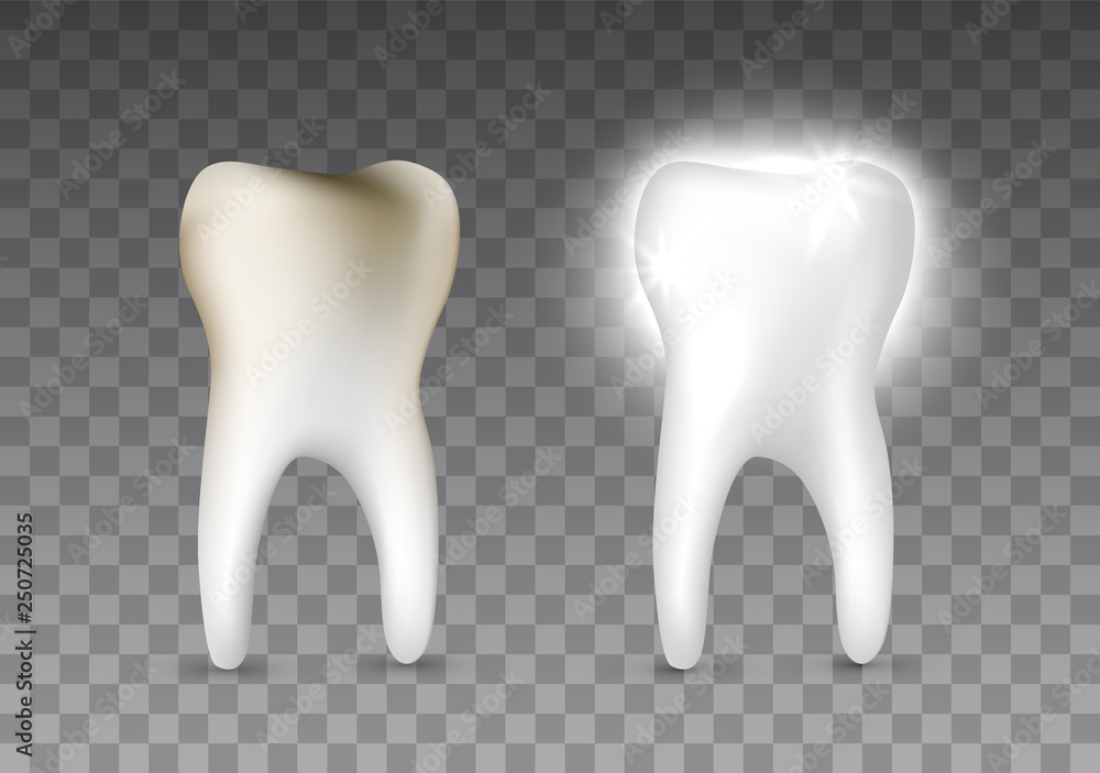 Beautiful realistic dentist vector set of decayed and white shiny tooth ...