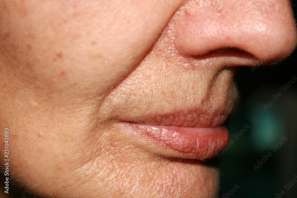 Wrinkles on the lips and chin. Nasolabial folds. Fluff mustache. Stock ...