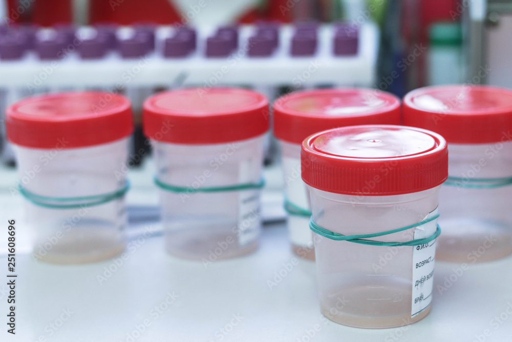 Sperm In Urine Sample