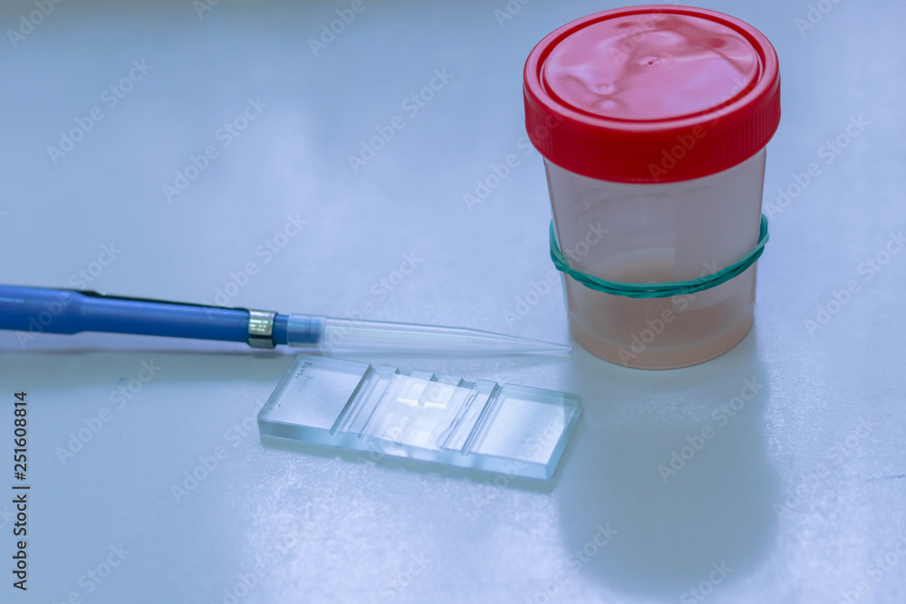 Sperm and urine samples in special test tubes for examination. On the ...