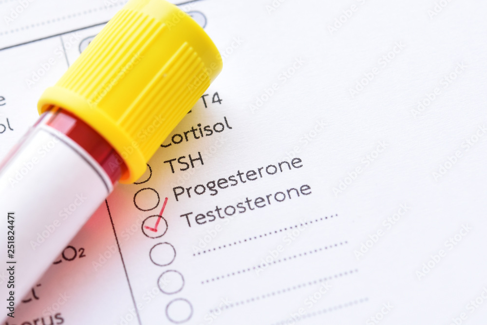 Blood sample tube with laboratory requisition form for testosterone ...