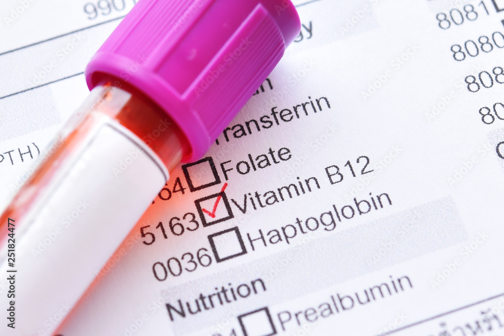 Blood sample tube with laboratory requisition form for vitamin B12 test ...