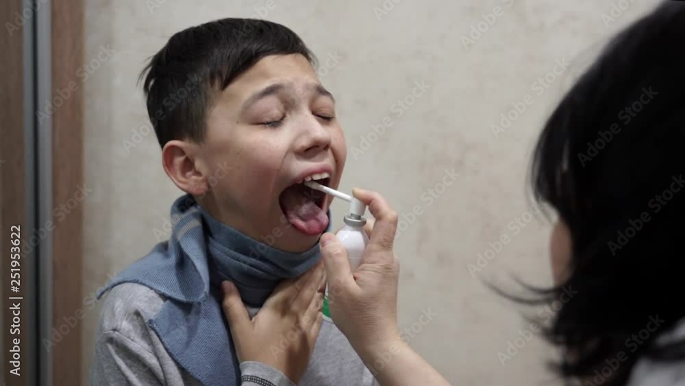 Angina, Mom Applies Medical Sprayer, child opens his mouth, Inhalation ...