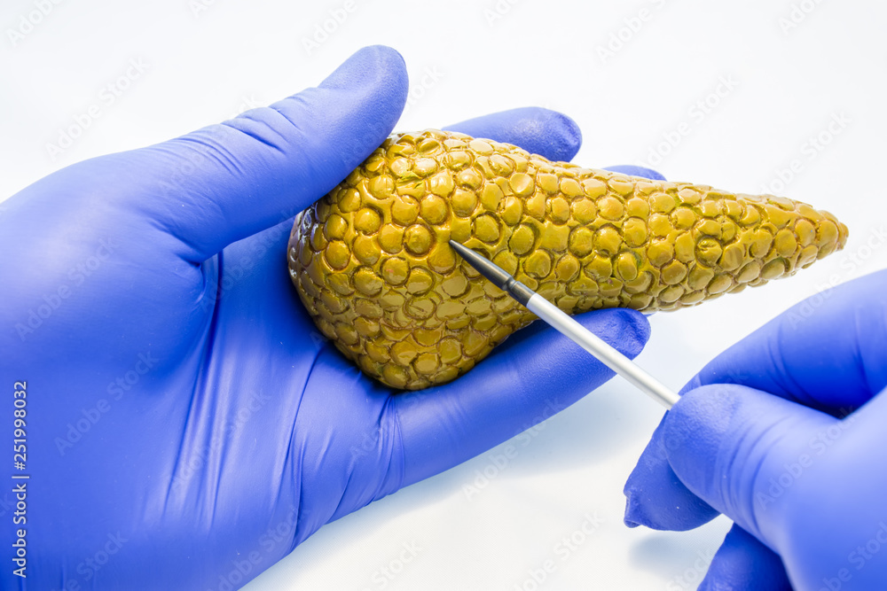 Doctor or scientist holds in gloved hand anatomical model of pancreas ...