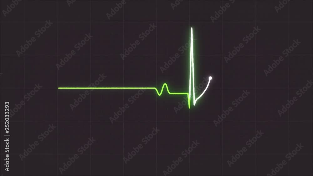 Vidéo Stock Abstract EKG Monitor showing heart beat on grey background ...