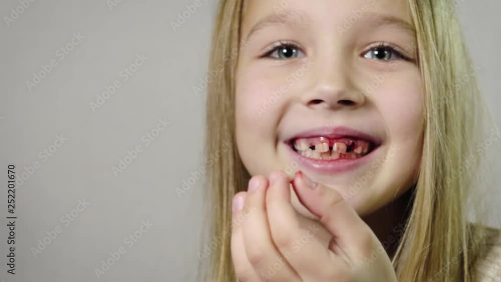 Close - up of a cute smiling girl, a child showing a torn milk Fang in ...
