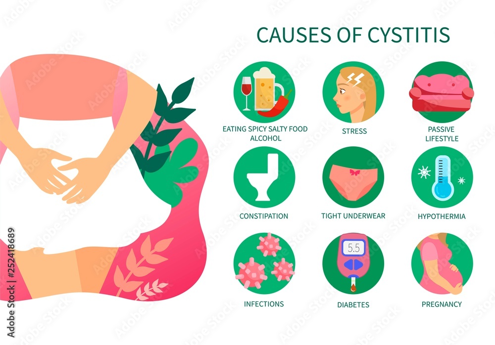 Vector medical poster reasons of cystitis. Diseases of the ...